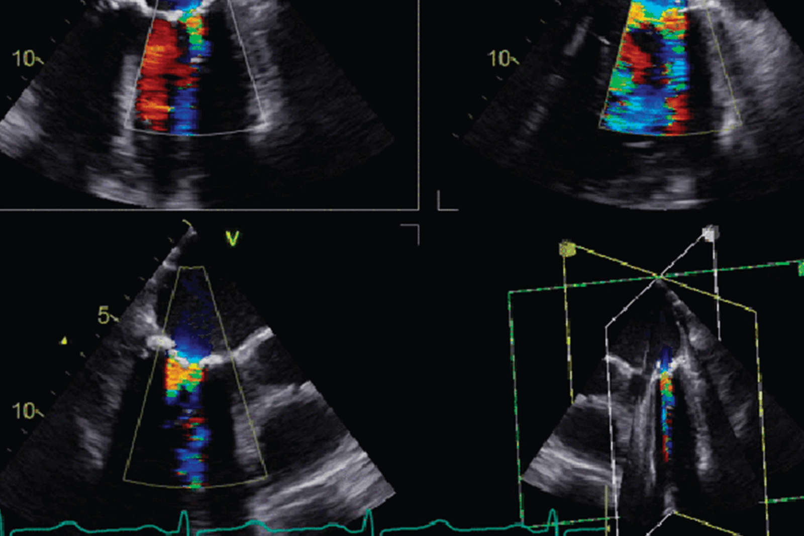 Ultrasounds | Professional Medical Equipment, INC