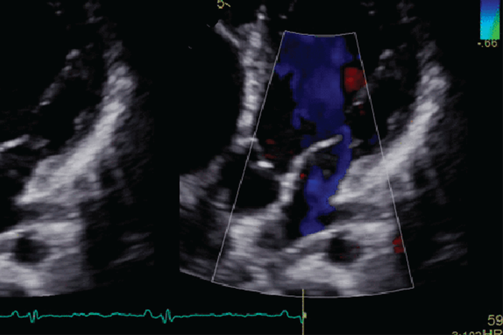 Ultrasounds | Professional Medical Equipment, INC
